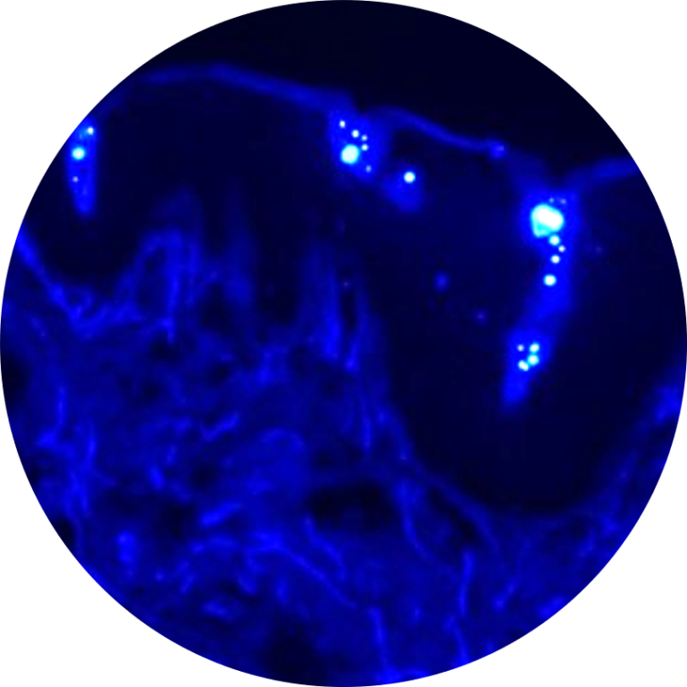 IN VITRO PERMEATION TESTING (IVPT) | PKDERM